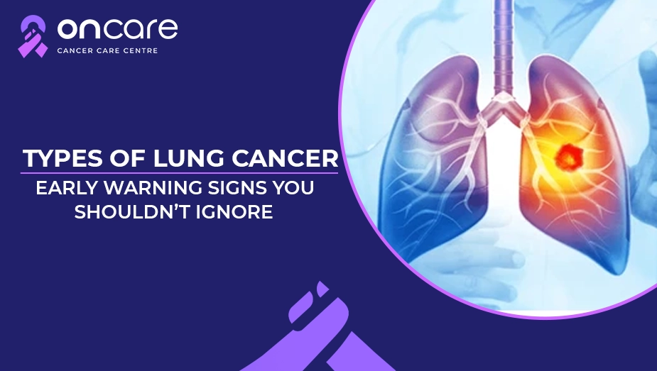 Stage 2 Lung Cancer Symptoms Diagnosis And Treatment Guide 8129